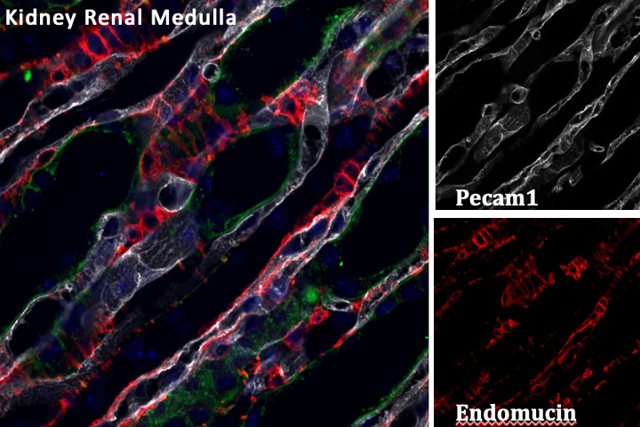 From Student to Scientist: A Summer of Hands-On Research: nephroHUB ...